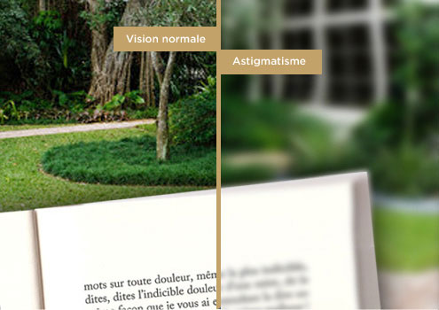 Presbyte, myope, astigmate, hypermétrope : quelle différence