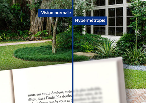 Presbyte, myope, astigmate, hypermétrope : quelle différence
